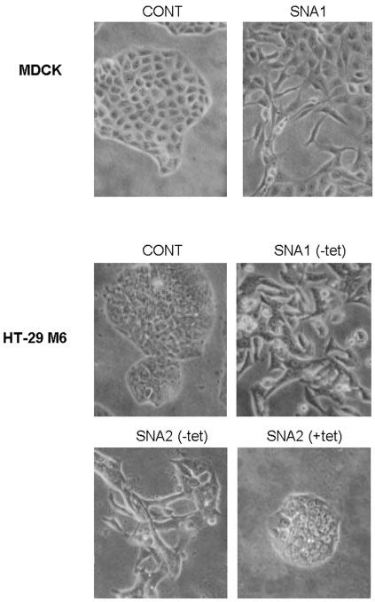 Morphology Of Ht 29 M6 And Mdck Clones Transfected With Sna