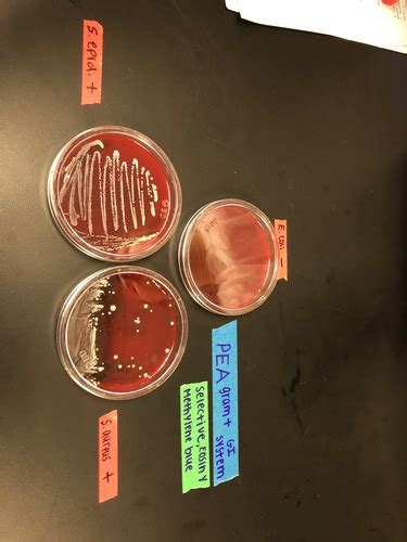 Microbiology Lab Flashcards Quizlet