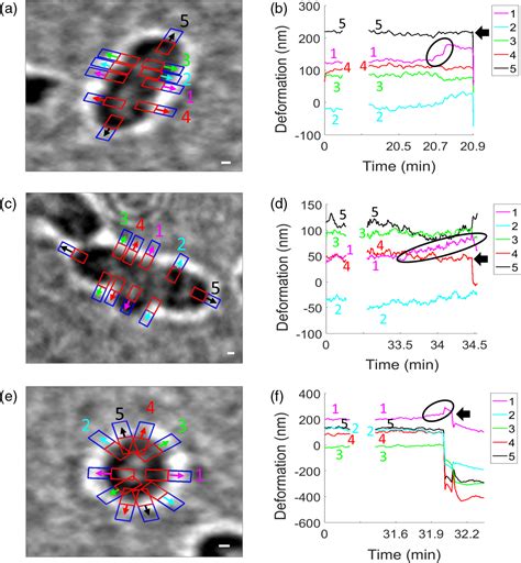 Real Time Detection Of Antibiotic Activity By Measuring Nanometer Scale