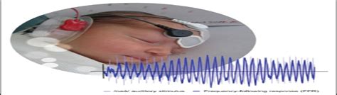 Neural Encoding Of Vocalic Sounds In Newborns The Hearing Journal