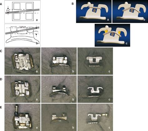 Effect Of Different Combinations Of Bracket Archwire And Ligature On Resistance To Sliding And