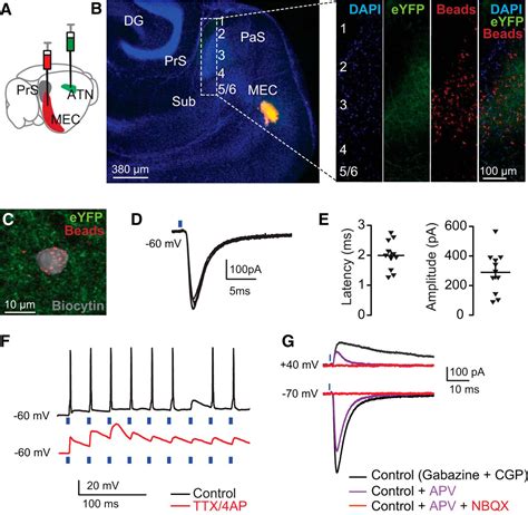 Anterior Thalamic Excitation And Feedforward Inhibition Of Presubicular Neurons Projecting To