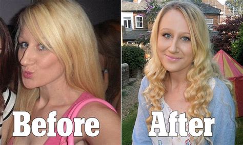 Shy Girl Fiona Todd Was So Paranoid About Her Looks She Underwent A Nose Job Daily Mail Online