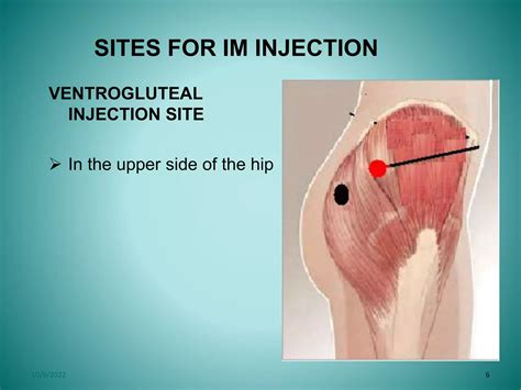 Administering Interamuscular Injectionspptx