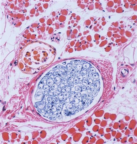 Muscle Spindle Light Micrograph Stock Image C0238252 Science