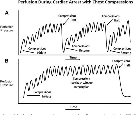 When Performing Cardiac Compressions What Is The Appropriate Depth Of