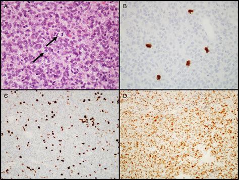 Pituitary Histology Of Pituitary Gland
