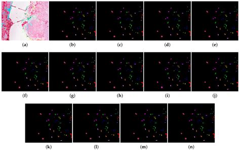 Hyperspectral Image Classification Based On Adaptive Globallocal Feature Fusion