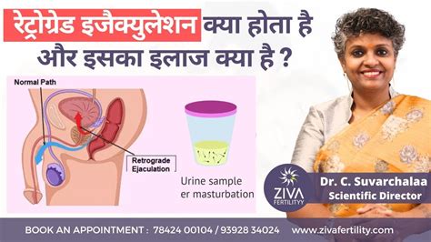 Retrograde Ejaculation Diagnosis And Treatment | रेट्रोग्रेड ...
