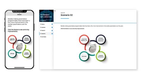 Benefits Of A Programable Pacemaker Enyota Learning Elearning