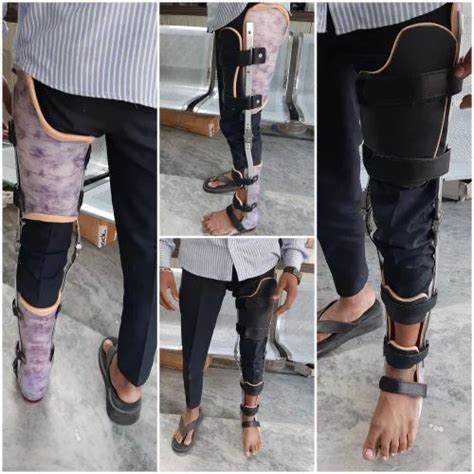 Polio Knee Caliper Brace For Disabled At ₹ 13500piece Hyderabad Id