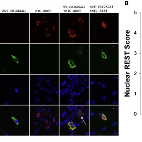 Subcellular Localization Of Recombinant Myc Rest And Wt Or Mut Prickle1