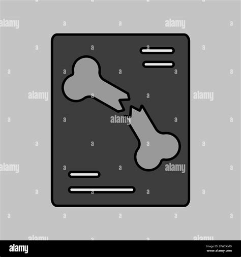 X Ray Pictures Of Broken Bones