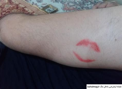 عکس کبودی گردن عاشقانه اینستا ️ بهترین تصاویر