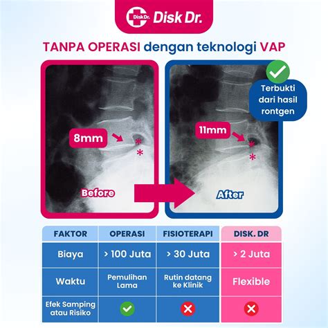 Jual Lumbar Traction Belt Disk Dr Wg50 G2 Alat Terapi Nyeri Pinggang