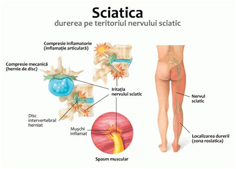 Nervul Sciatic Anatomie Si Fiziologie