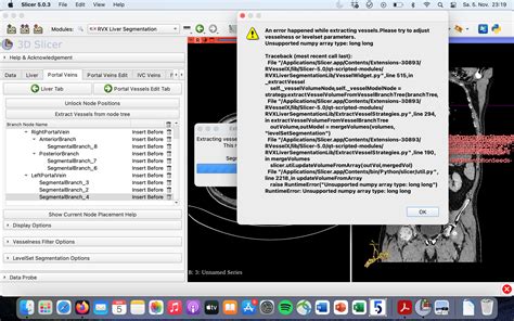 Vessel Segmentation Error Issue R Vessel X SlicerRVXLiverSegmentation GitHub