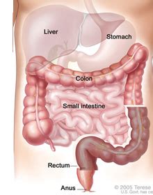 Sigmoid Colectomy Auckland Colorectal Centre