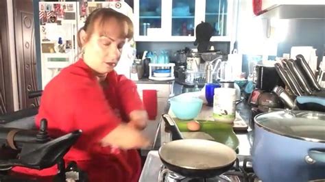 Hot Phocomelia Woman