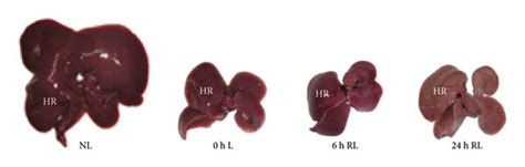 A Preparation Of Rat Two Third Hepatectomy Partial Hepatectomy Ph Download Scientific