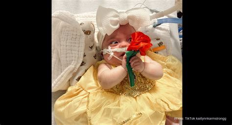 Micro Preemie Girl Outlives Doctors Predictions Dresses Up As