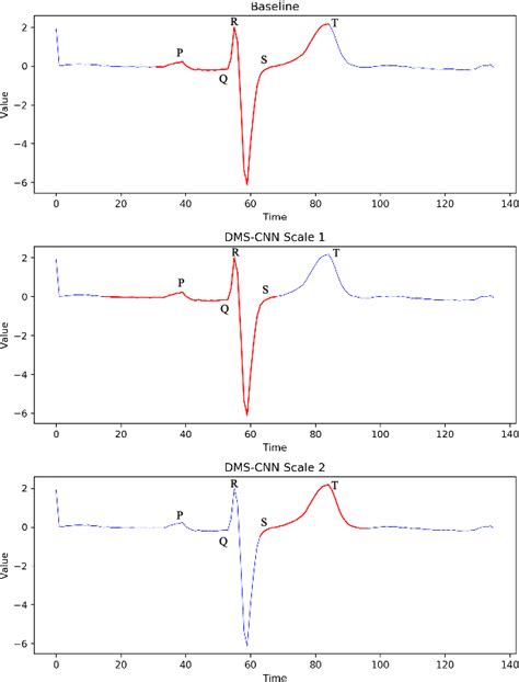Figure 8 From Dynamic Multi Scale Convolutional Neural Network For Time Series Classification