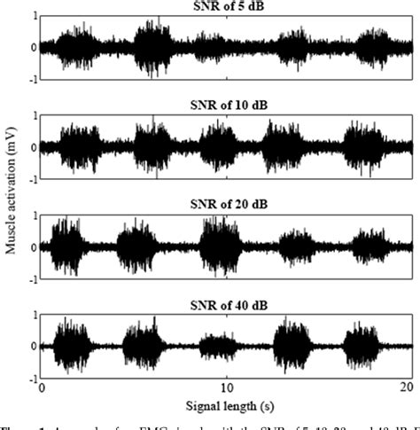 Figure 1 From Comparing The Accuracy Of Visual And Computerized Onset Detection Methods On