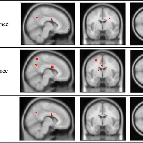 Inference Maps Of Meta Analysis Performed On NeuroSynth Showing