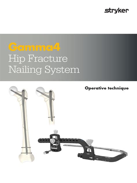 Gamma4 Hip Fracture Nailing Guide Pdf Magnetic Resonance Imaging Hip