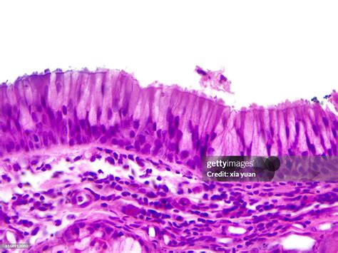 pseudostratified ciliated columnar epithelium solved a survey