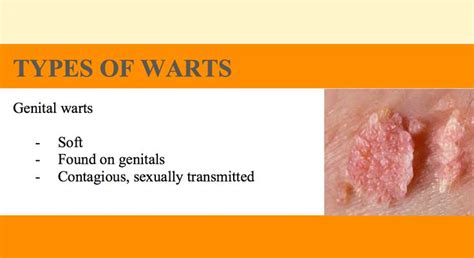 Pin Su Healing Warts NGO NG