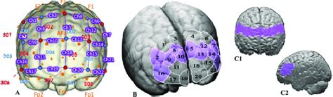 Abbildung 415 Fnirs Optode Montage Setup Topolayout With Marked Download Scientific Diagram