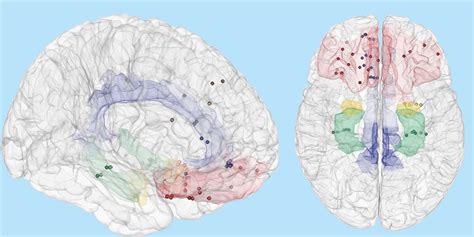 Researchers Decode Mood From Human Brain Signals Usc Viterbi School