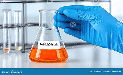 Scientific Research In Laboratory On Multiple Sclerosis Treatment Stock