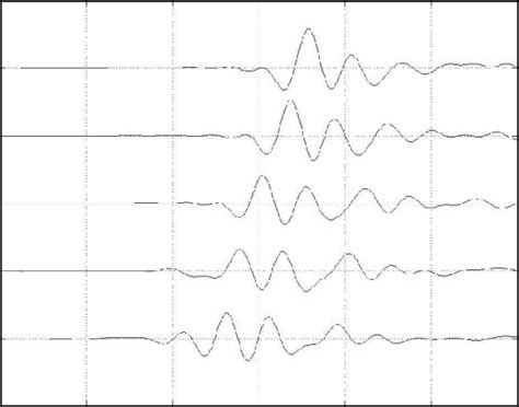 Traces Of A Cmp Gather A Before Trace Balancing And B After Trace Download Scientific