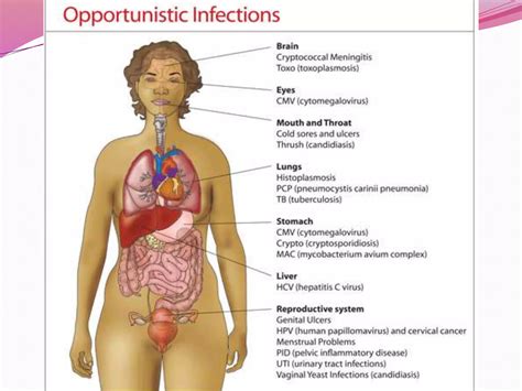 Sexually Transmitted Diseases STDs PPTX