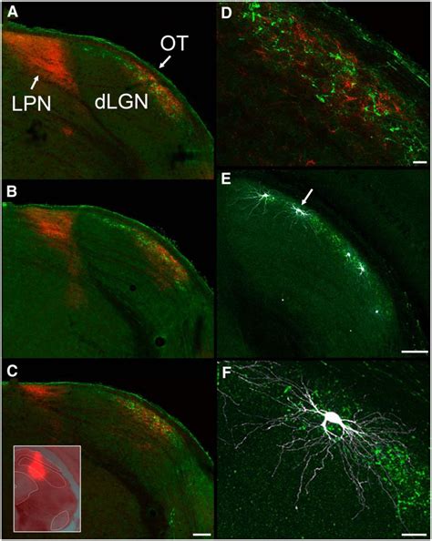 Medial Geniculate Nucleus Mouse