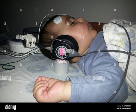 Brainstem Evoked Response Audiometry Also Auditory Brainstem Response Or Abr A Screening Test