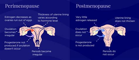 Menopause Symptoms Irregular Periods At Mildred Fulcher Blog