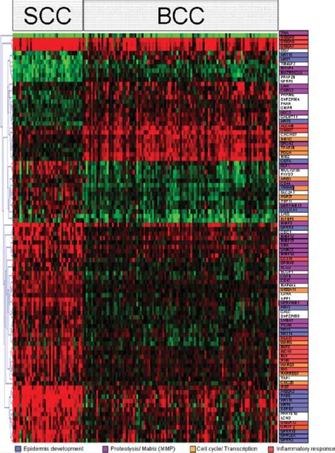 Genes Found To Be Differentially Expressed Between SCC And BCC In Download Scientific Diagram