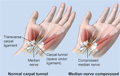 Clinical Anatomy Of The Wrist And Hand Flashcards Quizlet