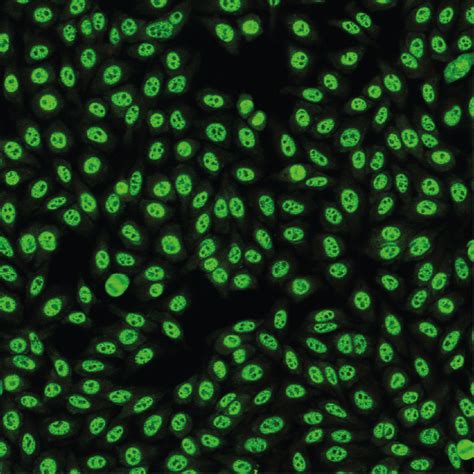 Test D Immunofluorescence Indirecte IFA Sebia FR