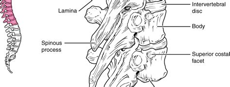 Thoracic Disc Herniation Arthurcare
