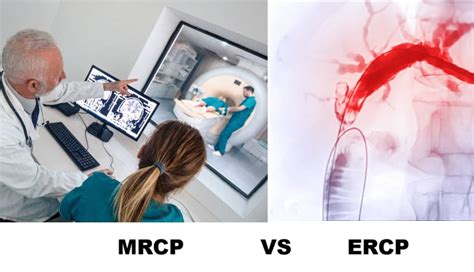 Mrcp Vs Ercp The Hidden Risks You Need To Know Before Deciding
