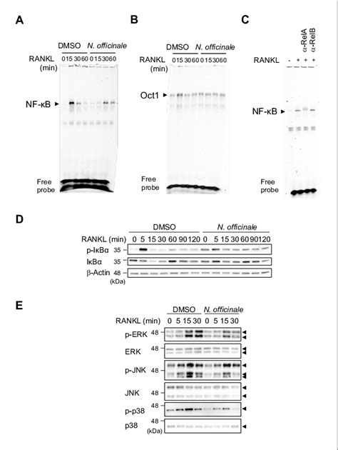 Inhibition of the canonical NF κB pathway and MAPK pathways by N Download Scientific Diagram
