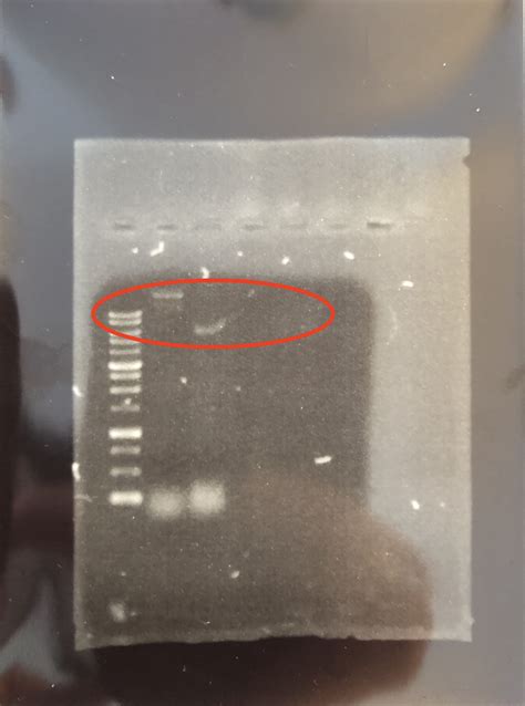 Bacterial Transformation Protocol Zabiologist
