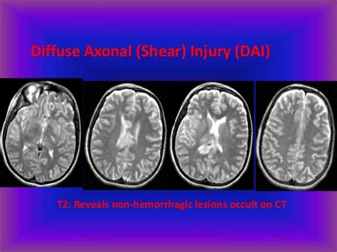 Ct And Mri Interpretation