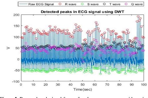Figure 1 From Emotion Detection Through Electrocardiogram Signal Classification In An Iot
