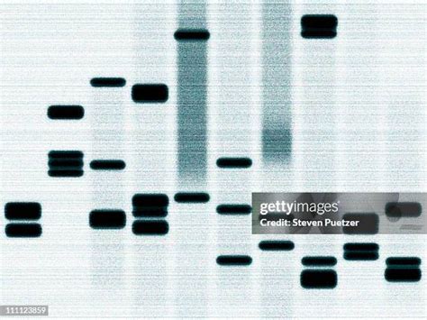 Dna Sequencing Gel Photos And Premium High Res Pictures Getty Images