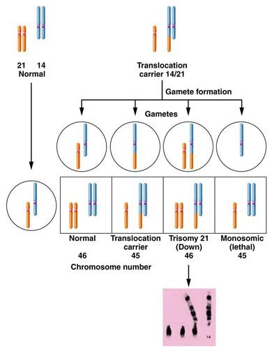 Genetic Diseases Flashcards Quizlet